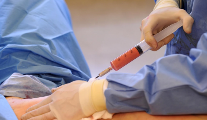 Why Some Women in Birmingham Are Overlooking The Dangers of BBL ...